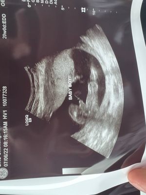 UHS CHENANGO MEMORIAL HOSPITAL - Updated December 2025 - 10 Reviews ...