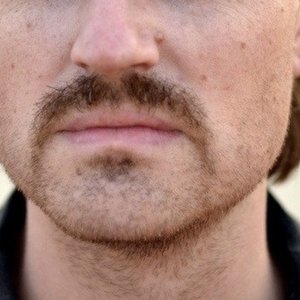 EVAN RANSOM, MD - 101 Photos & 164 Reviews - Cosmetic Surgeons - 450 ...