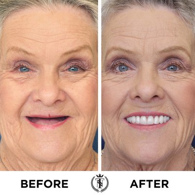 NEW TEETH NOW - 51 Photos - 2150 Harden Blvd, Lakeland, Florida - Oral ...