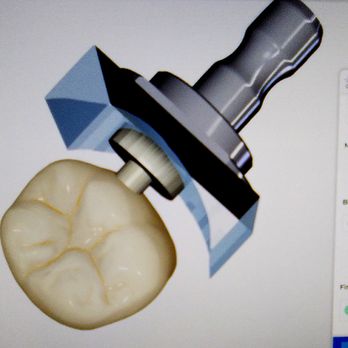 CARSON DENTAL DESIGNS - Updated December 2025 - 13 Photos & 26 Reviews ...