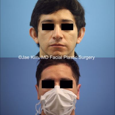 JAE KIM MD, FACIAL PLASTIC SURGERY - Updated January 2026 - 21 Photos ...