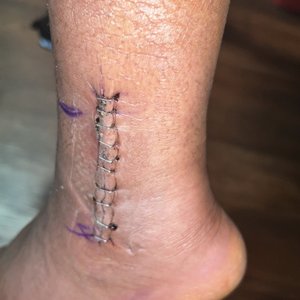 ORTHOSOUTH - Updated December 2025 - 1244 Primacy Pkwy, Memphis ...