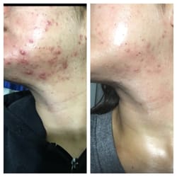 GEORGE HSIEH, MD - ADVANCED DERMATOLOGY & SKIN SURGERY - 14 Photos & 98 ...