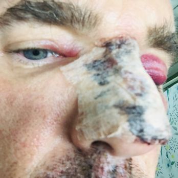 SPRING GOLDEN, MD - GOLDEN DERMATOLOGY - Updated August 2025 - 2226 ...