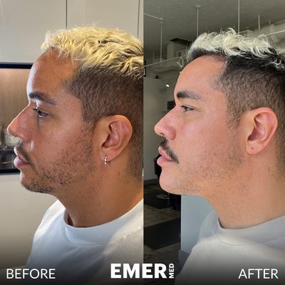 JASON EMER, MD - Updated July 2025 - 1158 Photos & 512 Reviews - 9201 ...