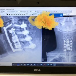 DR DANIEL AHOUBIM , MD - INJURY INSTITUTE - Updated December 2025 ...