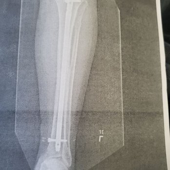 MAMMOTH HOSPITAL - Updated December 2025 - 47 Photos & 134 Reviews - 85 ...