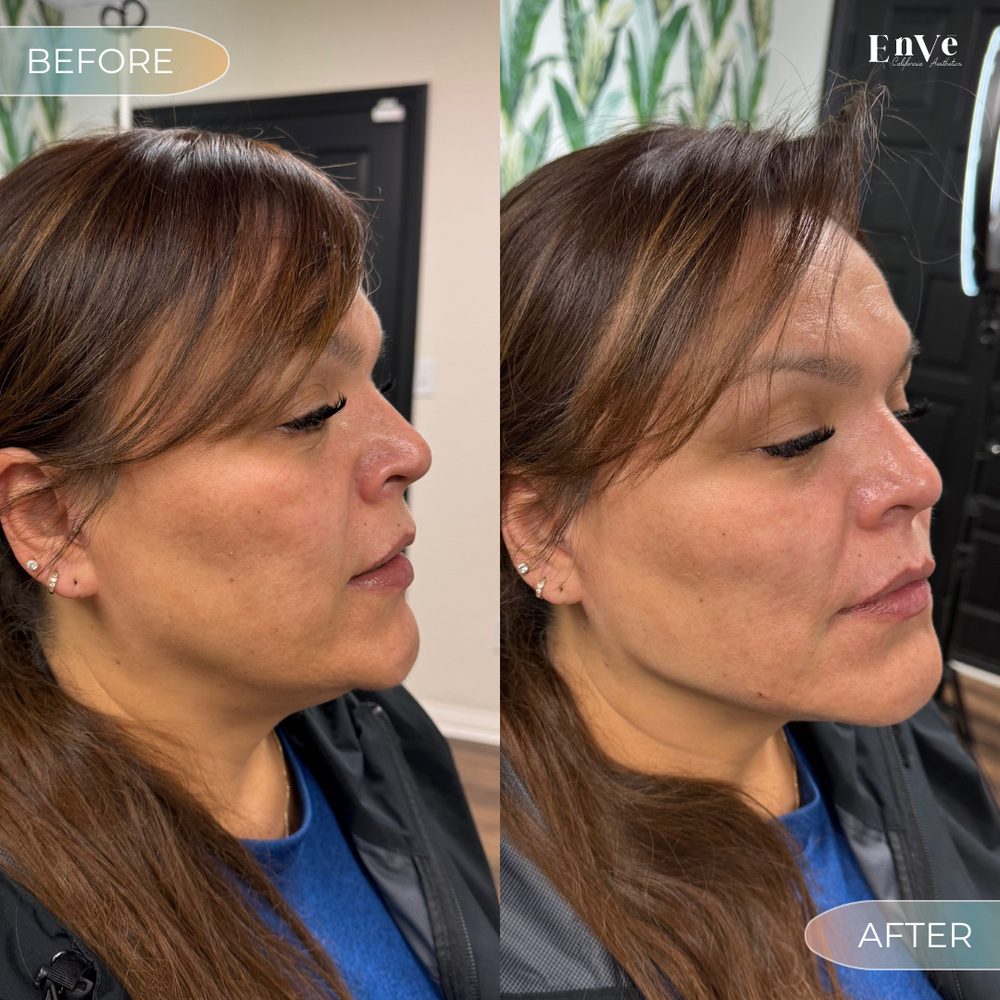 ENVE CALIFORNIA AESTHETICS - TEMP. CLOSED - Updated September 2025 - 10 Photos - 474 E 17th St ...