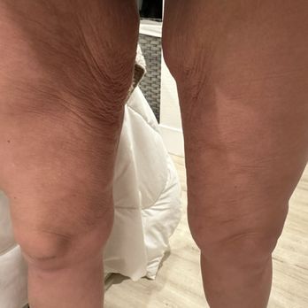 BRIAN M PARRETT, MD - Updated August 2025 - 73 Reviews - 2351 Clay St ...