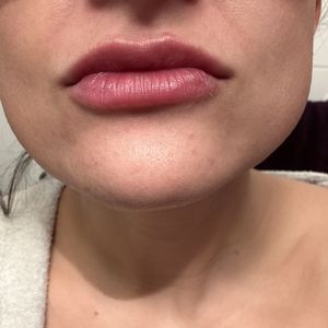 ADVANCED DERMATOLOGY - Updated May 2025 - 14 Photos & 61 Reviews - 510 ...