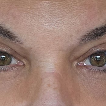 MEHRYAR RAY TABAN MD - OCULOPLASTIC SURGEON - 478 Photos & 273 Reviews ...