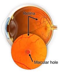 Malkani Retina Center Updated February 2026 9201 Cypress Lake Dr