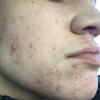 SCHWEIGER DERMATOLOGY GROUP- MILFORD - Updated January 2026 - 12 ...