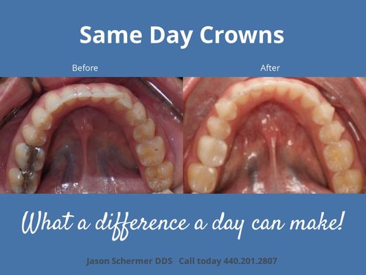 JASON A SCHERMER, DDS - EXCEPTIONAL SMILES AT LANDERBROOK - Updated ...