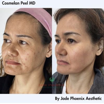 JADE PHOENIX AESTHETIC MEDICINE - Updated December 2025 - 25 Photos ...