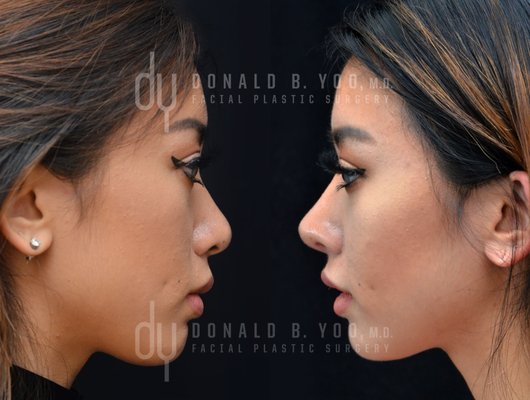 DONALD B YOO, MD, FACS - Updated December 2025 - 378 Photos & 249 ...