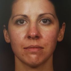 REBECCA FITZGERALD MD - 34 Photos & 162 Reviews - 321 N Larchmont Blvd ...