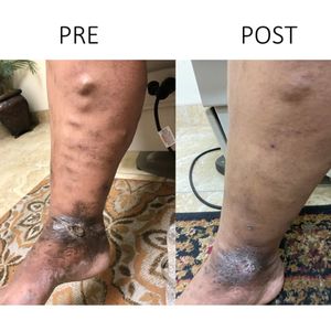 ATUL AGGARWAL, MD - Updated April 2025 - 11 Photos & 29 Reviews - 9330 ...