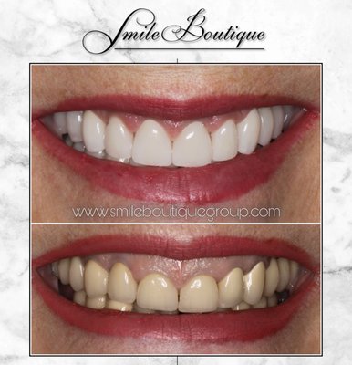 Smile Boutique Beverly Hills