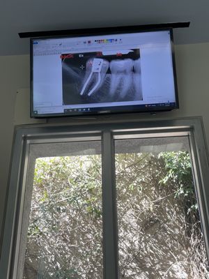 ROOTVISION ENDO - Updated January 2026 - 54 Photos & 212 Reviews - 3663 ...