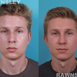 JEFFREY RAWNSLEY, MD - RAWNSLEY PLASTIC SURGERY - 61 Photos & 76 ...