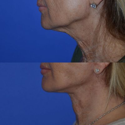 ASHKAN GHAVAMI, MD - Updated December 2025 - 242 Photos & 165 Reviews ...