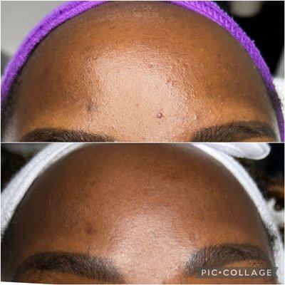 UNBLEMISHED SKIN STUDIO - Updated December 2025 - 100 Photos & 15 ...