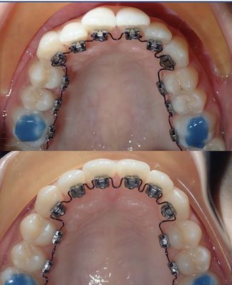 EMBRACE ORTHODONTICS - Updated May 2026 - 107 Photos & 110 Reviews ...