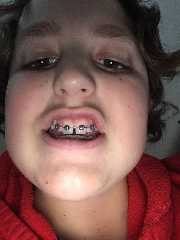 SUMMER ORTHODONTICS - 16 Photos & 57 Reviews - 451 Manhattan Beach Blvd ...