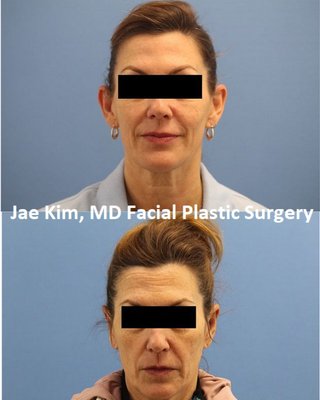 JAE KIM MD, FACIAL PLASTIC SURGERY - Updated December 2025 - 21 Photos ...