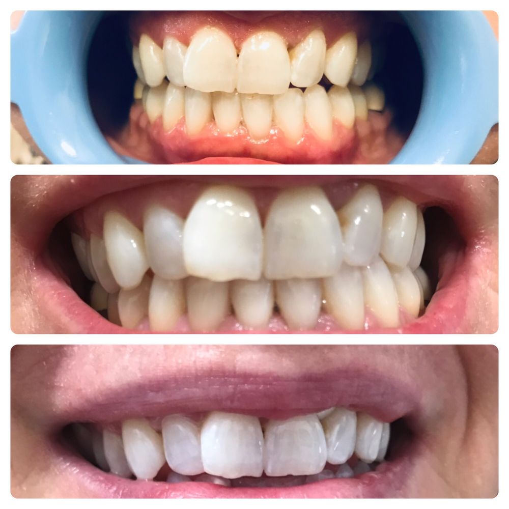 STUDIO SMILES - Updated June 2025 - 4205 S Gilbert Rd, Chandler ...