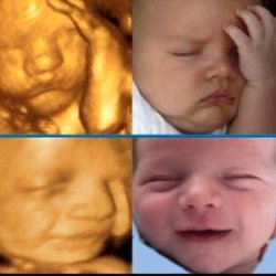 DELRAY MRI - 10 Photos - Diagnostic Imaging - 5270 Linton Blvd, Delray ...