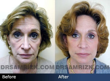 SAM RIZK, MD - Updated October 2025 - 102 Photos & 63 Reviews - 1040 ...