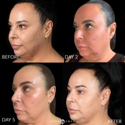 JASON EMER, MD - 928 Photos & 390 Reviews - 9201 Sunset Blvd, West ...