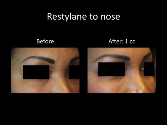 LAFACE BY LAURA PHAN, MD - Updated January 2026 - 35 Photos & 64 ...