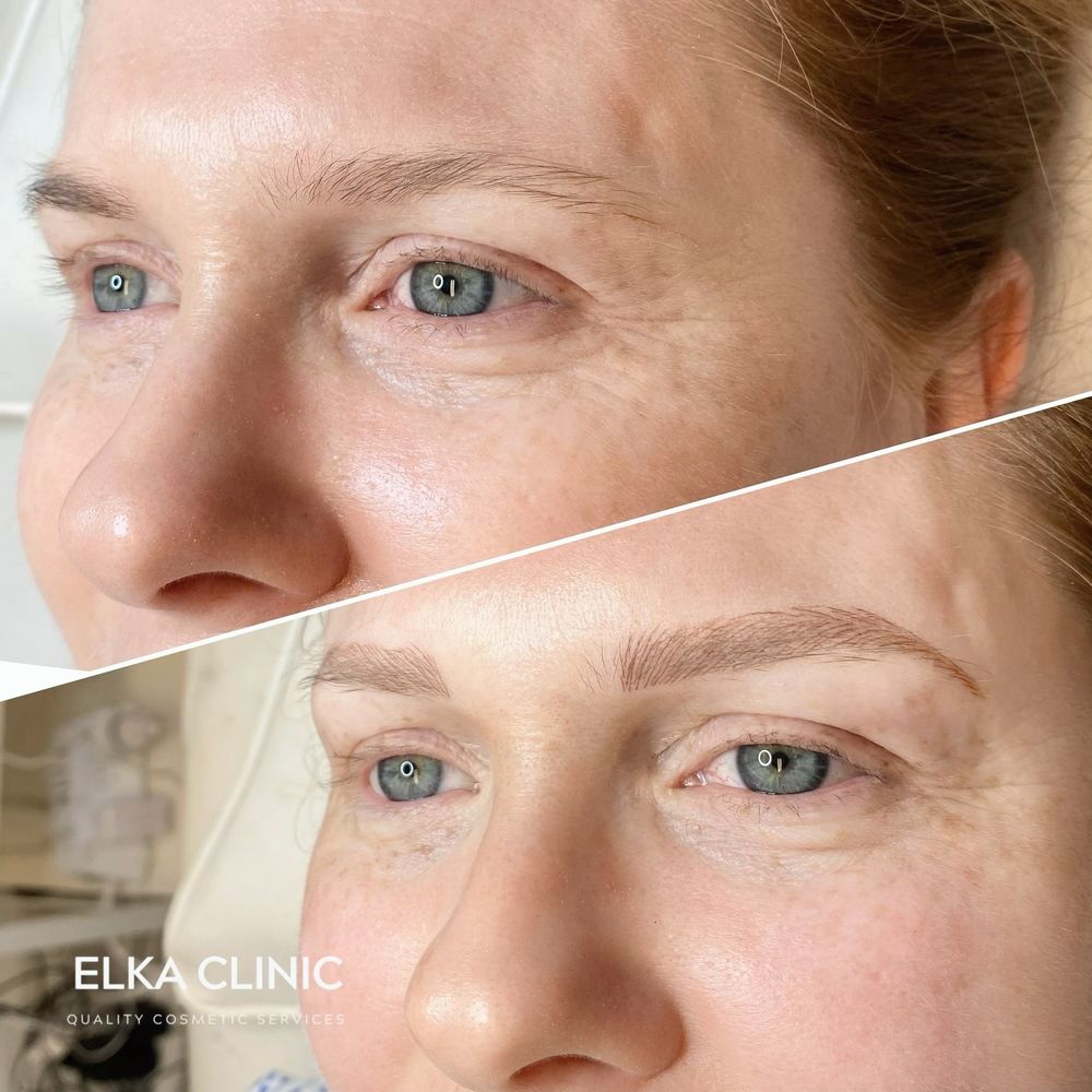 ELKA CLINIC - Updated June 2025 - 162 Photos - 3/29 Hood street ...