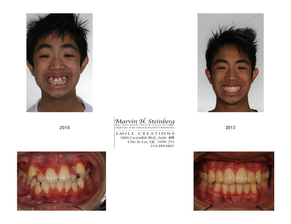 MARVIN STEINBERG - SMILE CREATION - Updated May 2026 - 5800 Boulevard ...