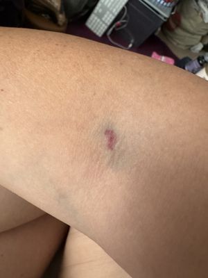 LABCORP - Updated December 2025 - 39 Photos & 133 Reviews - 2622 Ocean ...