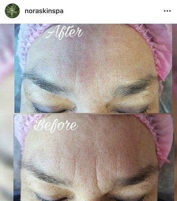 NORA SKIN SPA - Updated July 2025 - 10 Reviews - 4948 Windy Hill Dr ...