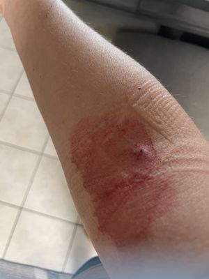 BIOLIFE PLASMA SERVICES - Updated October 2025 - 61 Photos & 241 ...