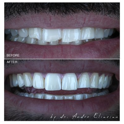 ANDRE ELIASIAN, DDS - ELITE DENTAL GROUP - Updated September 2025 - 83 ...