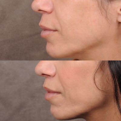 BEN TALEI, MD - Updated December 2025 - 258 Photos & 204 Reviews - 465 ...