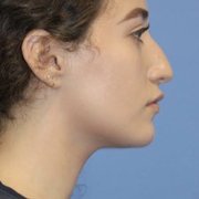 EVAN RANSOM, MD - 123 Photos & 171 Reviews - Cosmetic Surgeons - 450 ...