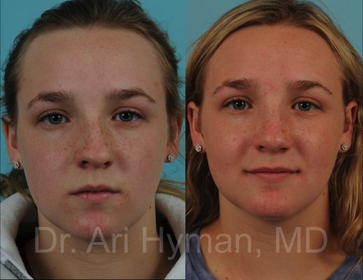 ARI HYMAN, MD - Updated October 2024 - 388 Photos & 57 Reviews - 16311 ...