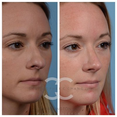 CONGRESSIONAL PLASTIC SURGERY | CHRISTOPHER C. CHANG, M.D - Updated ...