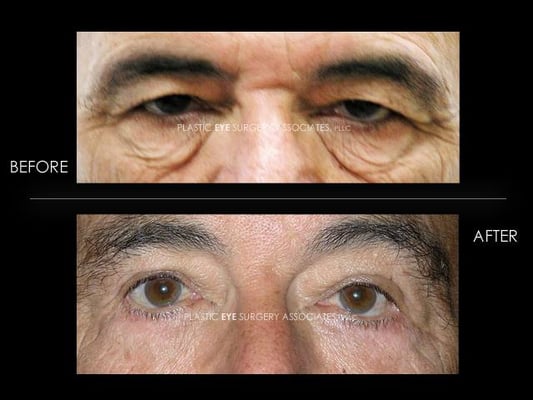 PLASTIC EYE SURGERY ASSOCIATES - Updated December 2025 - 52 Photos & 13 ...