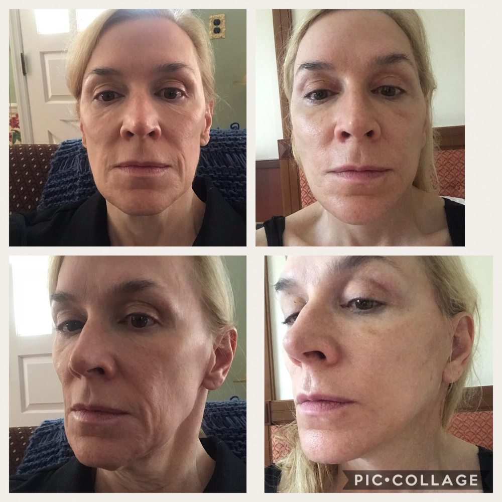 WILLIAMS CENTER PLASTIC SURGERY SPECIALISTS - 18 Photos & 11 Reviews ...