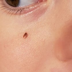 DERMASPAMED - 16 Reviews - 340 James Way, Pismo Beach, California ...