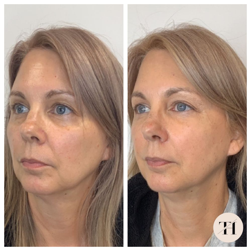 Caroline Ruhl's Instagram, Twitter & Facebook on IDCrawl