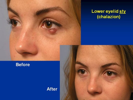 Mehryar Ray Taban Md Oculoplastic Surgeon Updated May 2025 526 Photos And 349 Reviews 9735